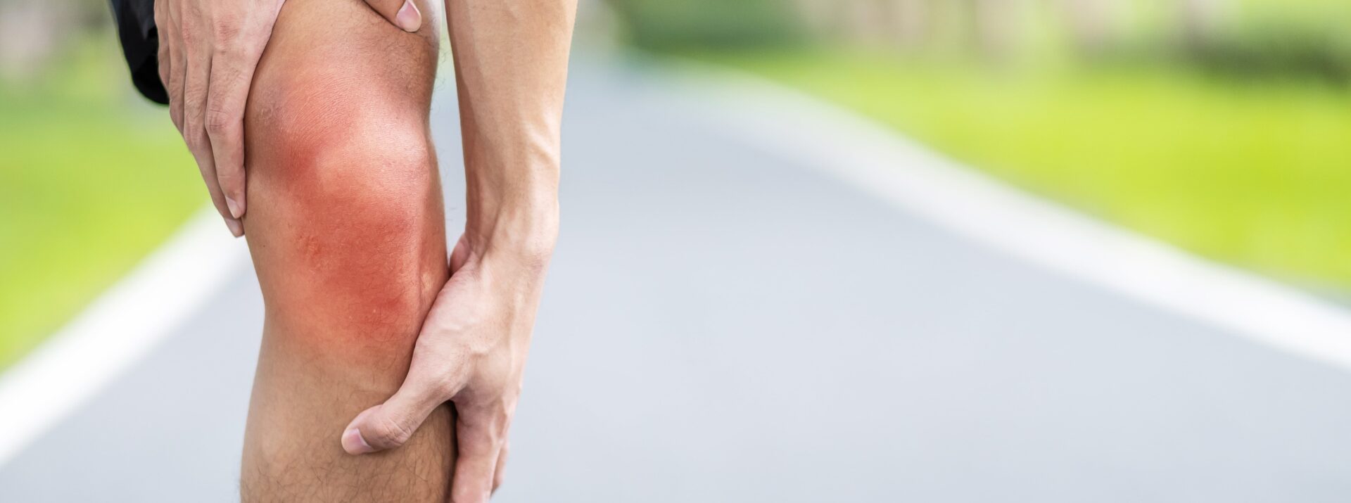 Tendinitis Rotuliana: Enfoque Integral para Sanar tu Rodilla